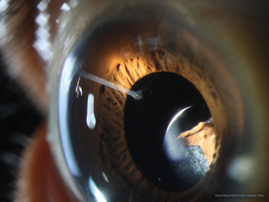 Haag-Streit Slit lamps